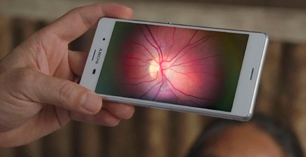 Peek Retina: Smartphone-Gadget kÃ¤mpft gegen Blindheit › Weblogit